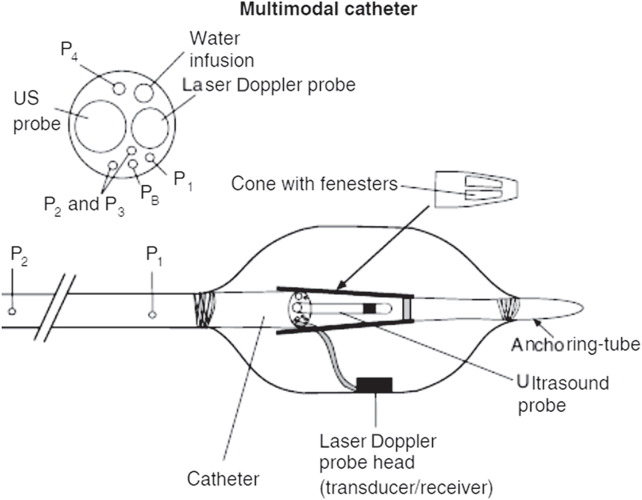 Ultrasound imaging for assessing functions of the GI tract - IOPscience