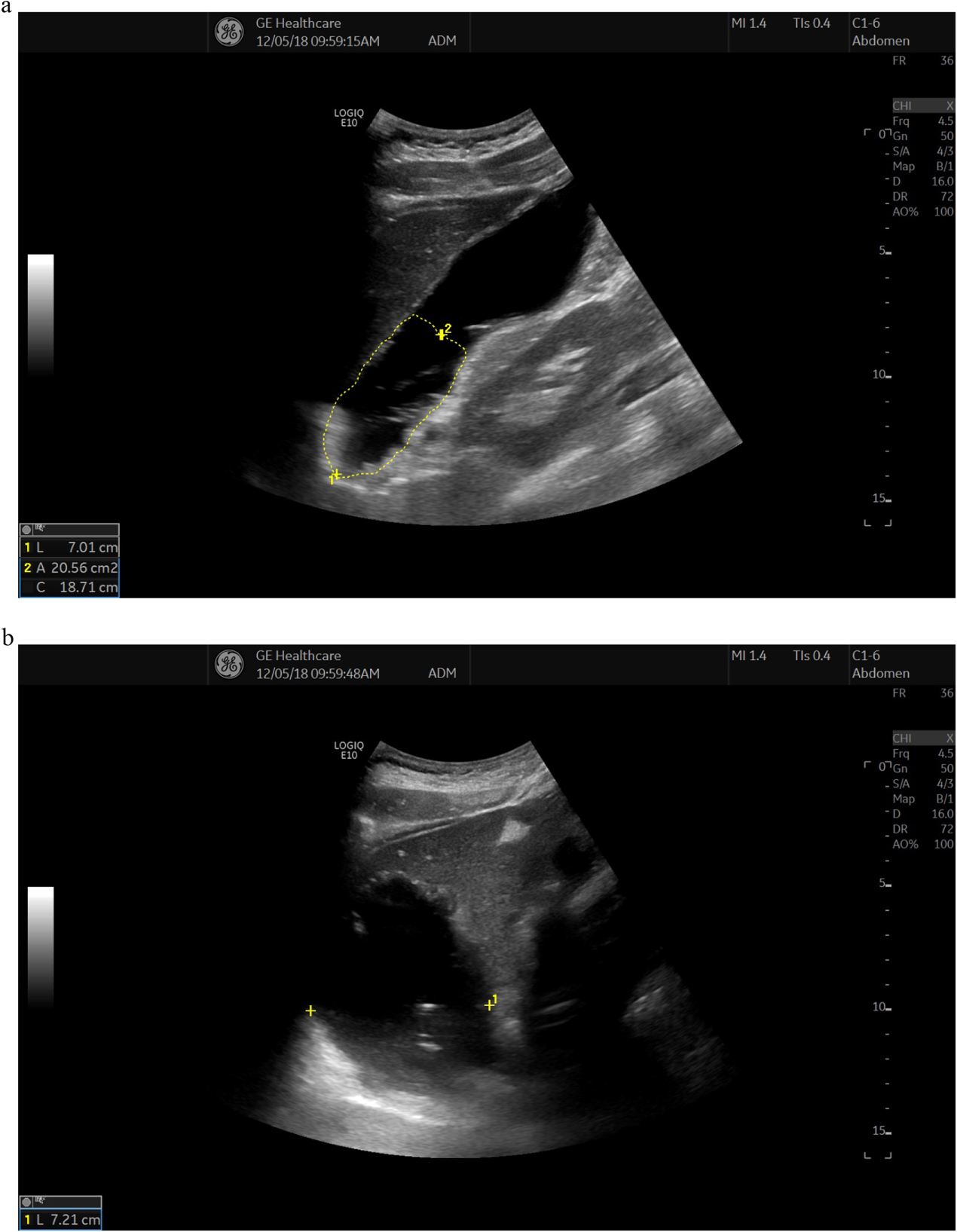 Ultrasound imaging for assessing functions of the GI tract - IOPscience