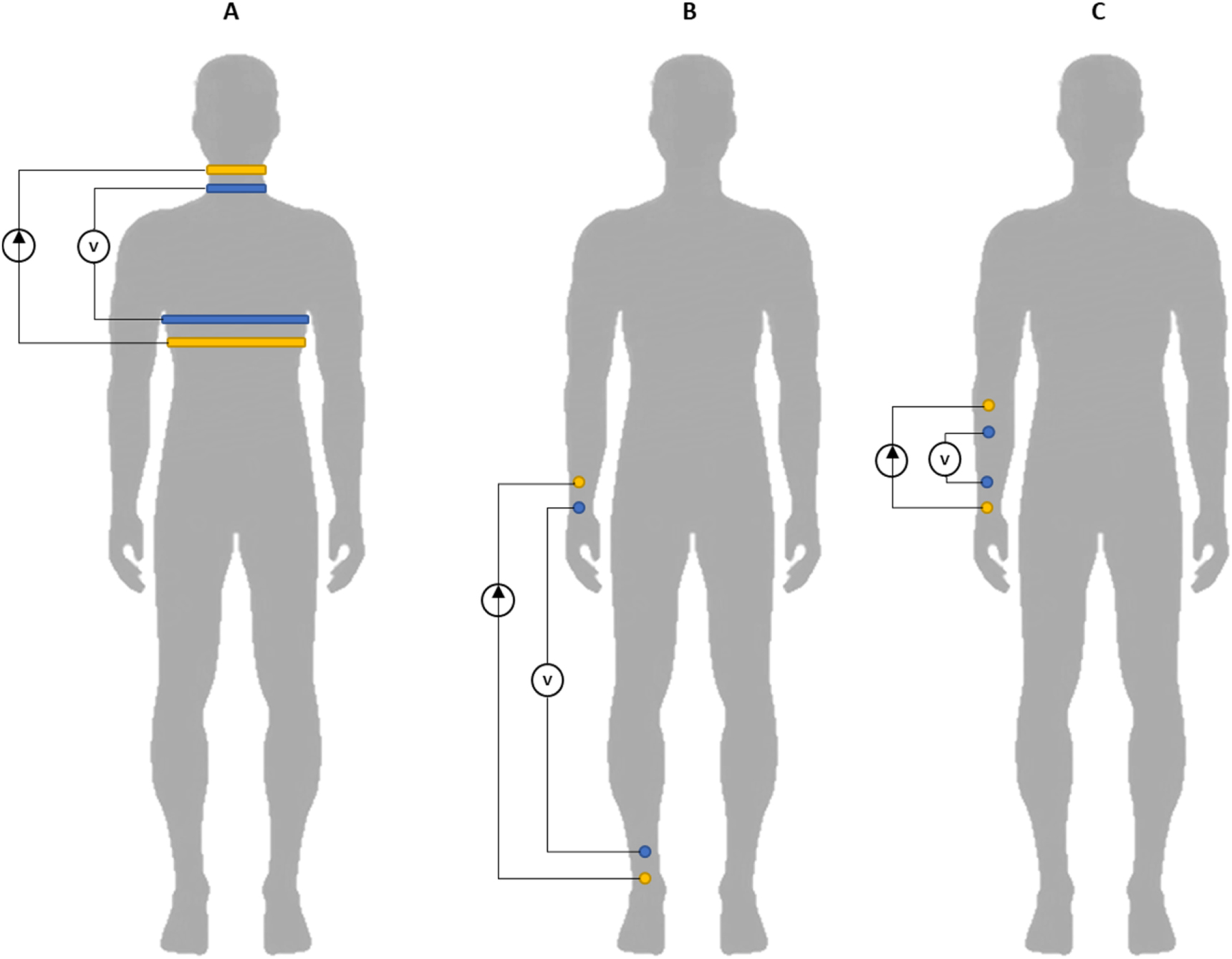 Bioimpedance analysis as a tool for hemodynamic monitoring: overview ...