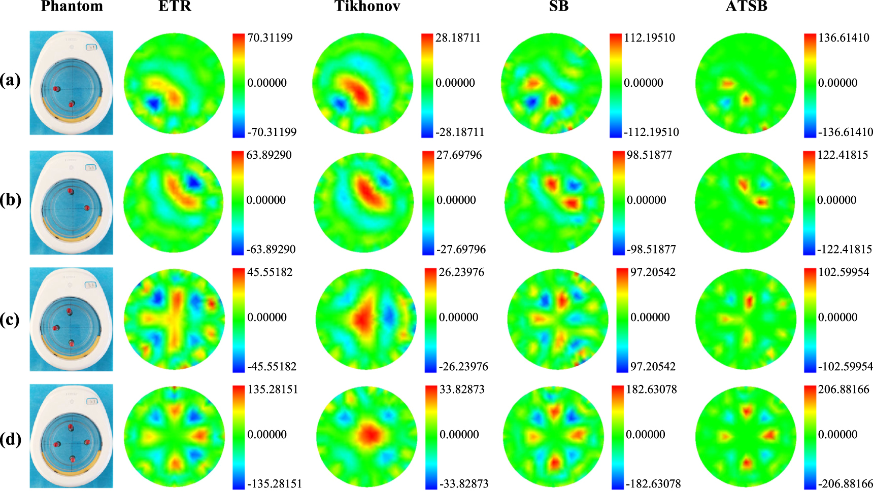 Adaptive threshold split Bregman algorithm based on magnetic induction tomography for brain ...