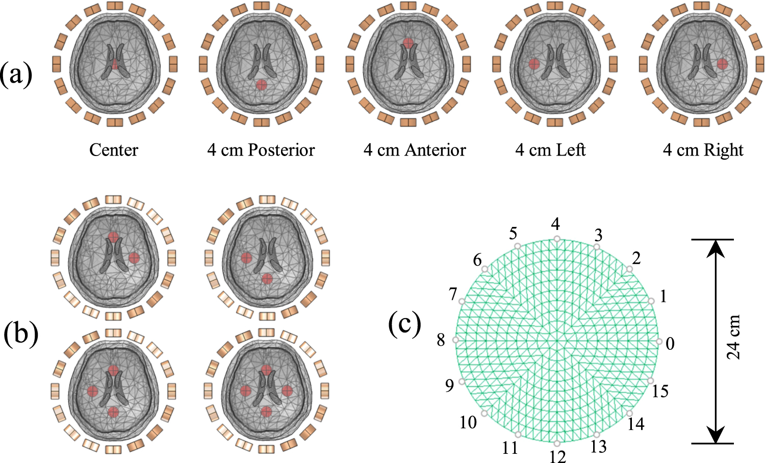 Adaptive threshold split Bregman algorithm based on magnetic induction tomography for brain ...
