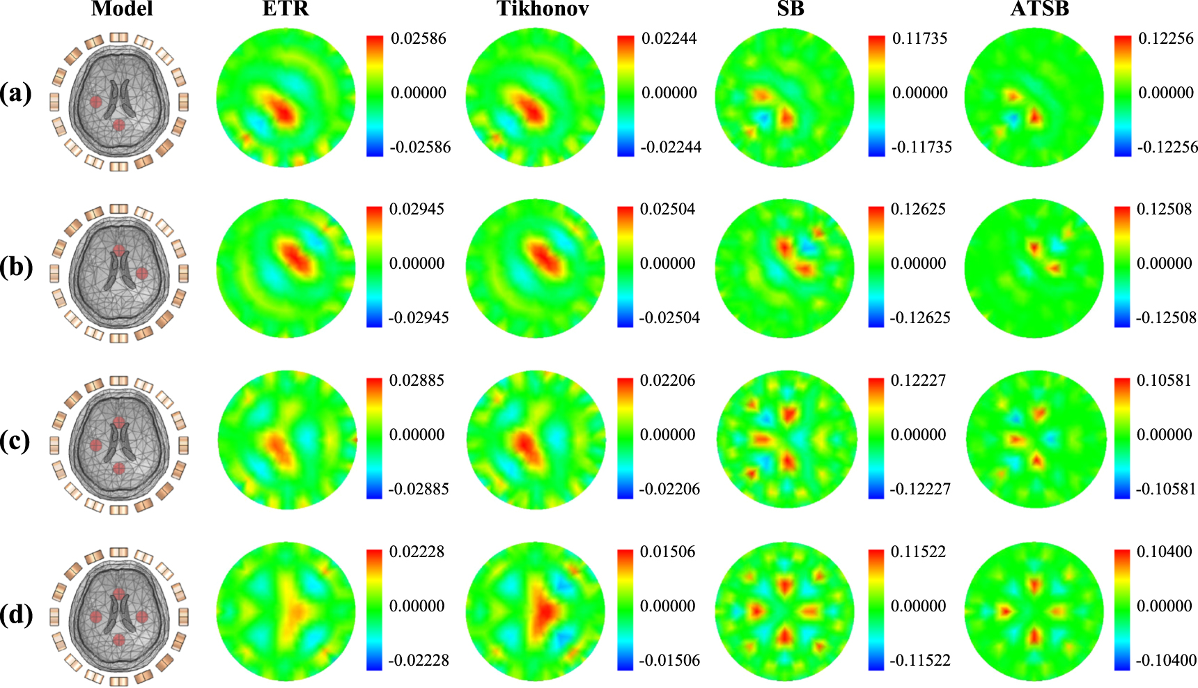 Adaptive threshold split Bregman algorithm based on magnetic induction tomography for brain ...