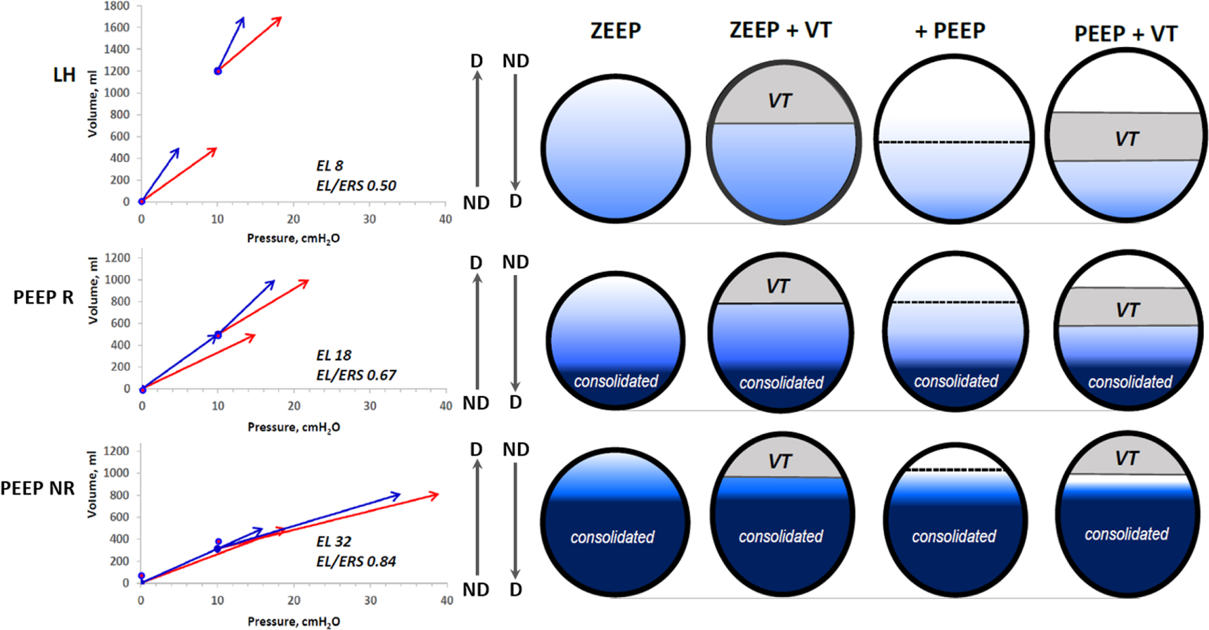 Gas distribution by EIT during PEEP inflation: PEEP response and ...