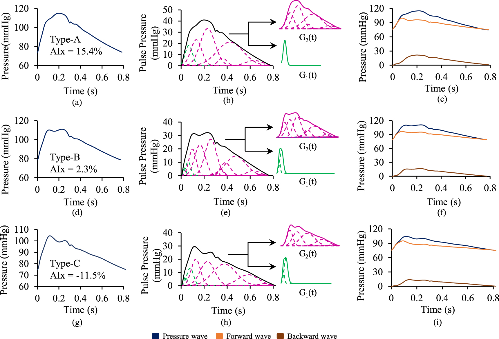 Arterial pressure pulse wave separation analysis using a multi-Gaussian decomposition model ...
