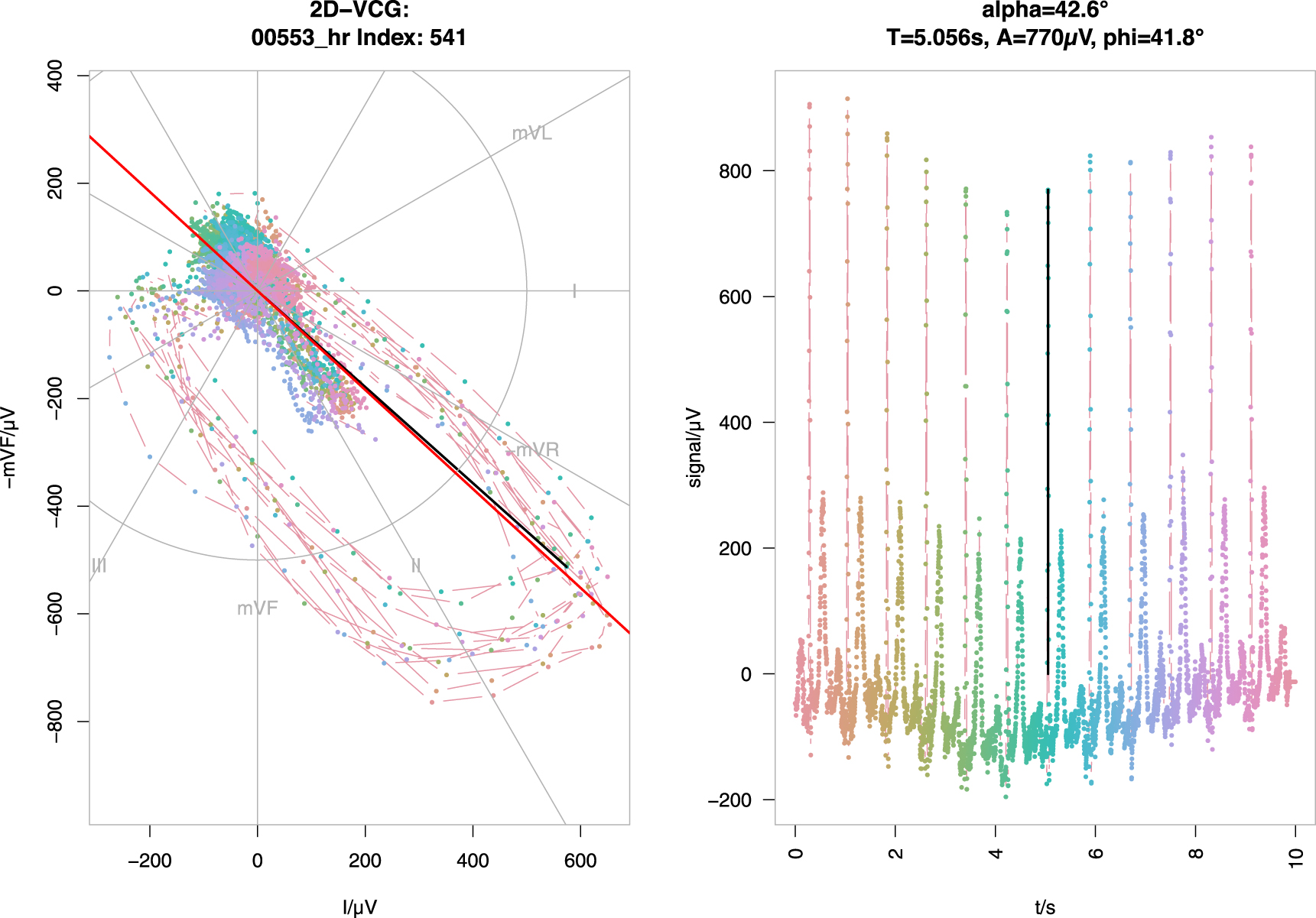 Completing the Cabrera Circle: deriving adaptable leads from ECG limb ...