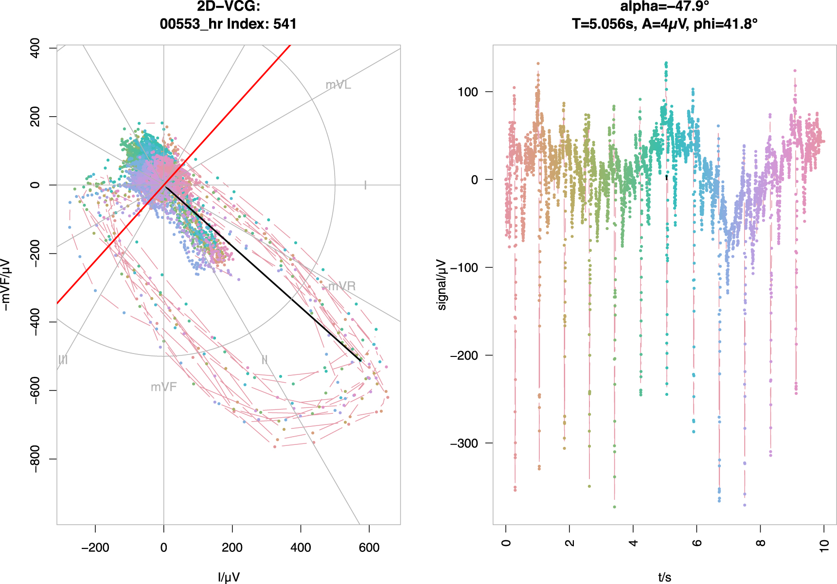 Completing the Cabrera Circle: deriving adaptable leads from ECG limb ...