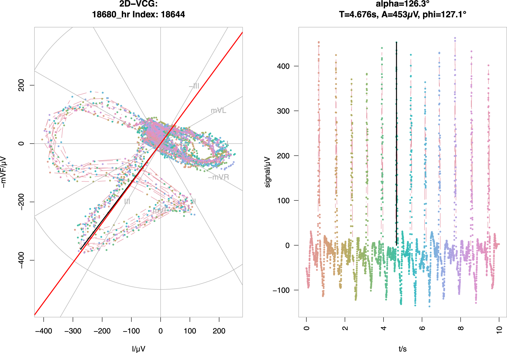 Completing the Cabrera Circle: deriving adaptable leads from ECG limb ...