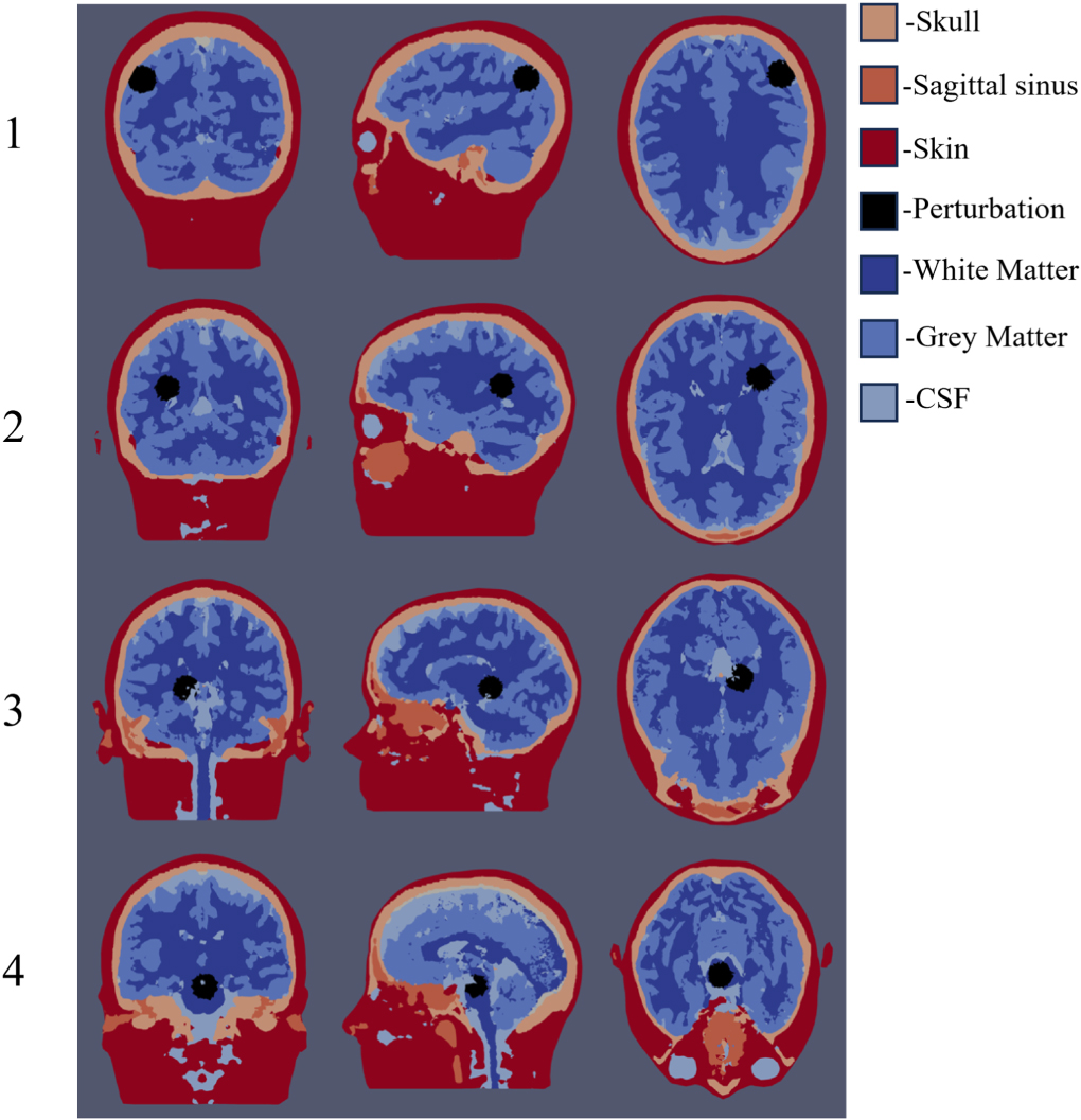 Non-invasive imaging of neural activity with magnetic detection ...