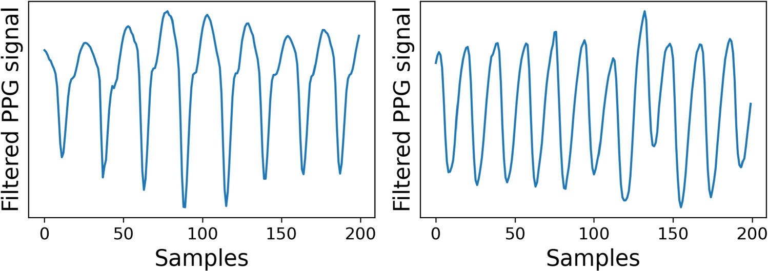 Physiological sensor data cleaning with autoencoders - IOPscience