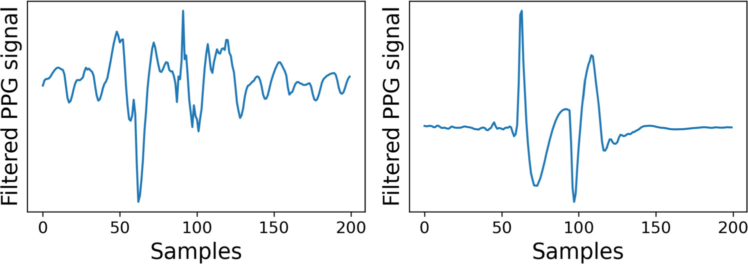 Physiological sensor data cleaning with autoencoders - IOPscience