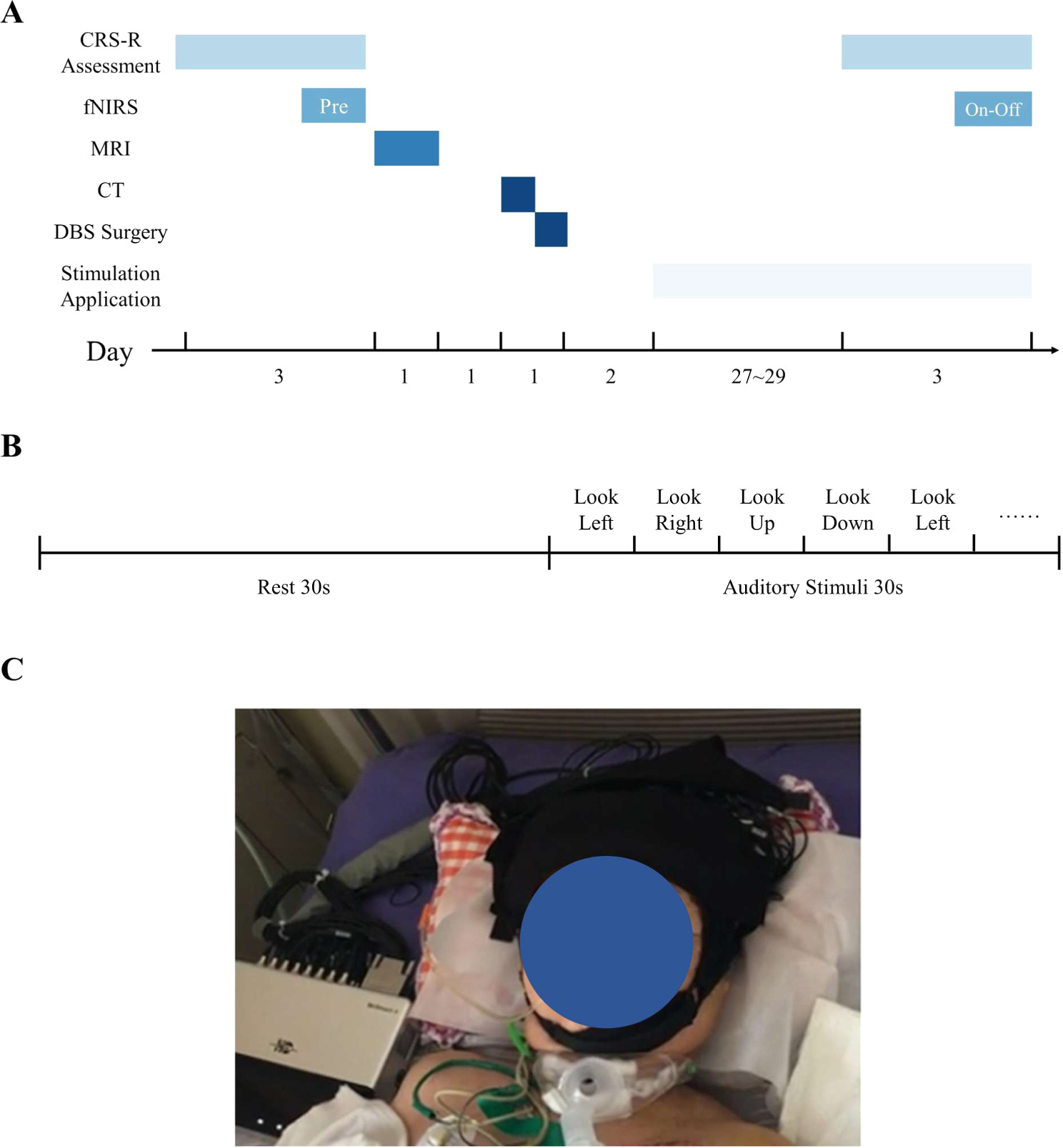 Effective DBS treatment improves neural information transmission of ...