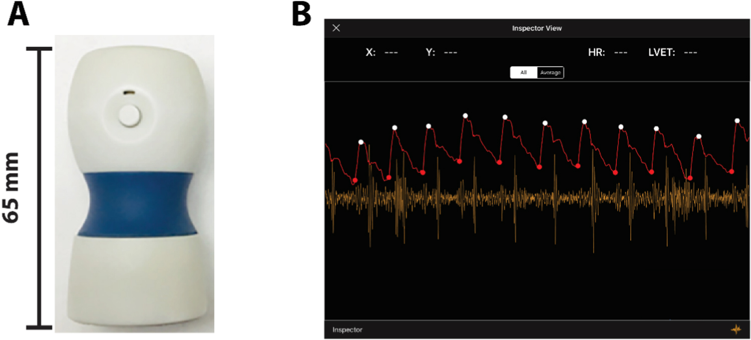 Screening left ventricular systolic dysfunction in children using ...