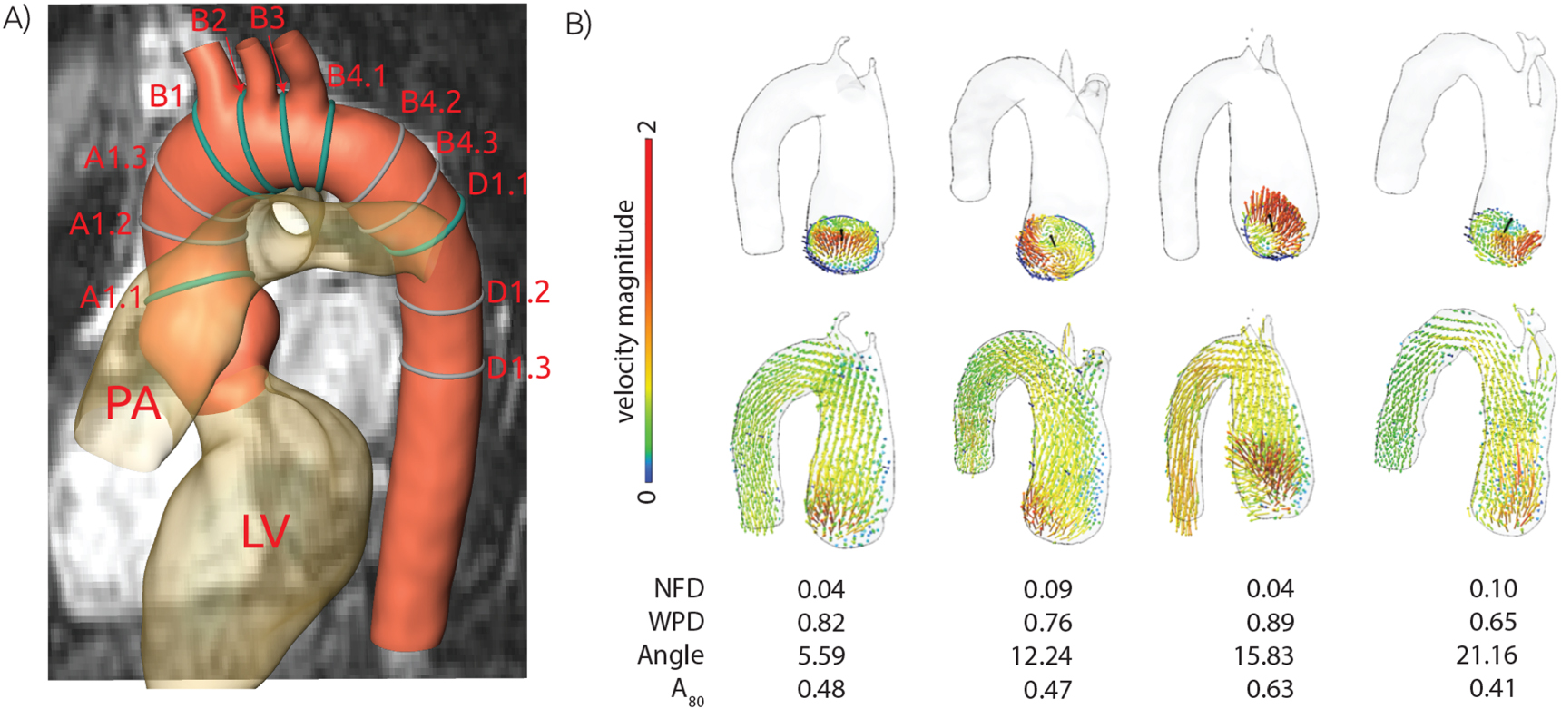 Population-based reference values for 4D flow MRI derived aortic blood ...