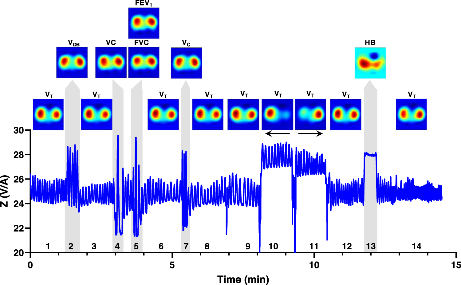 Wearable pulmonary monitoring system with integrated functional lung ...