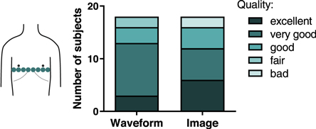Wearable pulmonary monitoring system with integrated functional lung imaging and chest sound ...