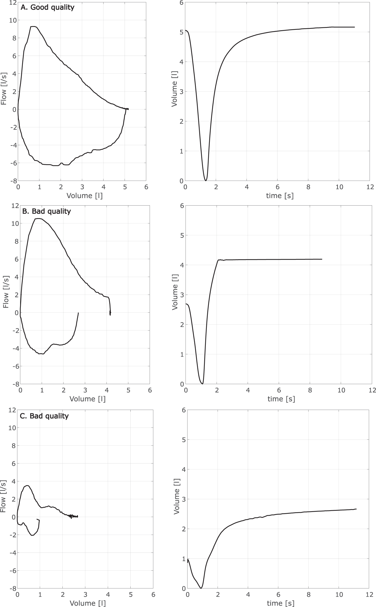 Deep learning algorithm for visual quality assessment of the spirograms ...