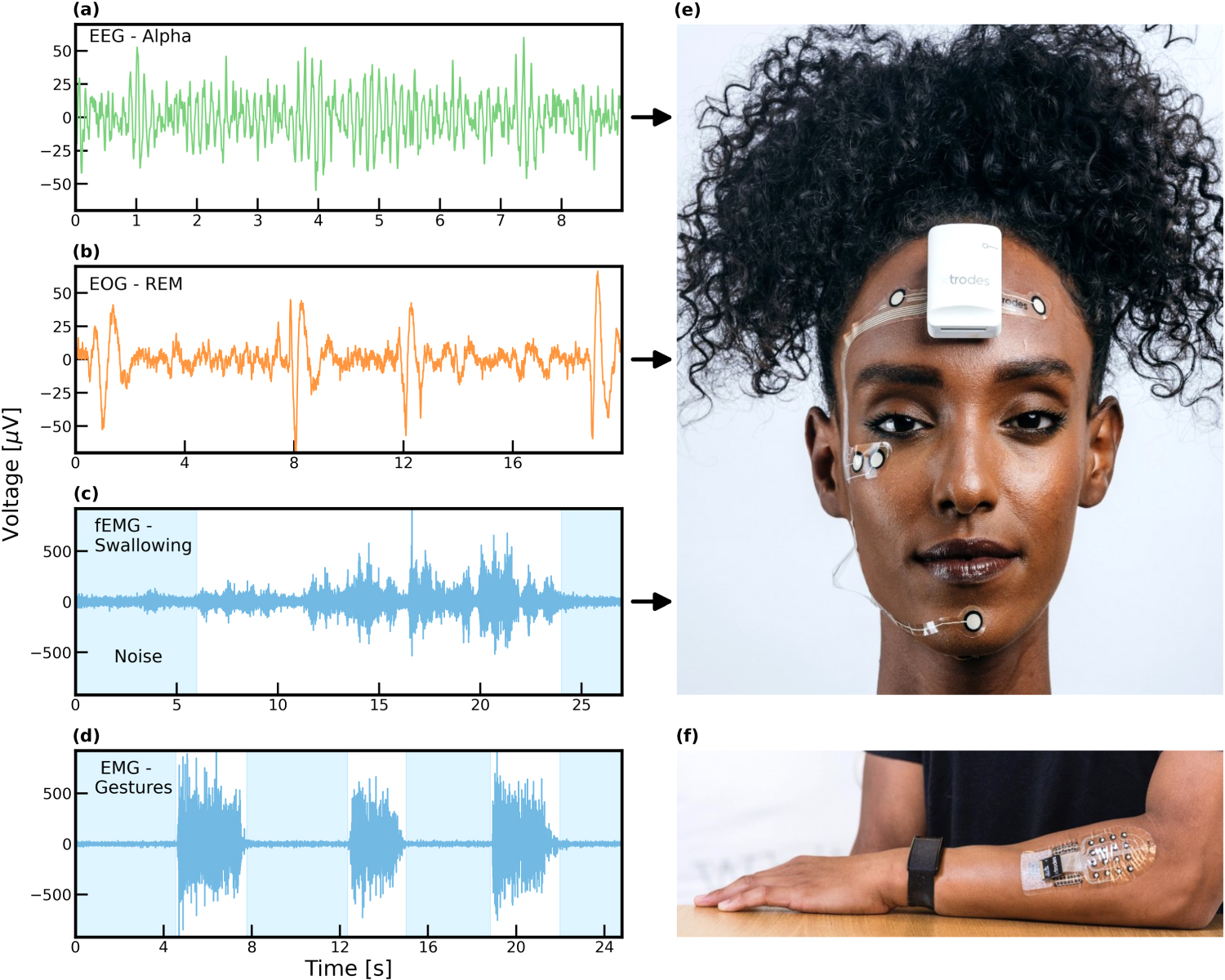 Bio-potential noise of dry printed electrodes: physiology versus the ...