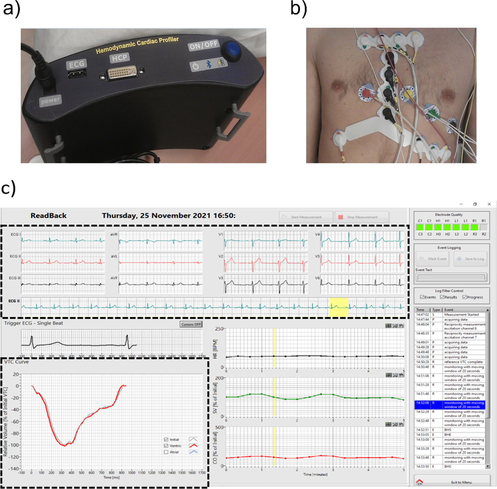 The hemodynamic cardiac profiler volume-time curves and related ...