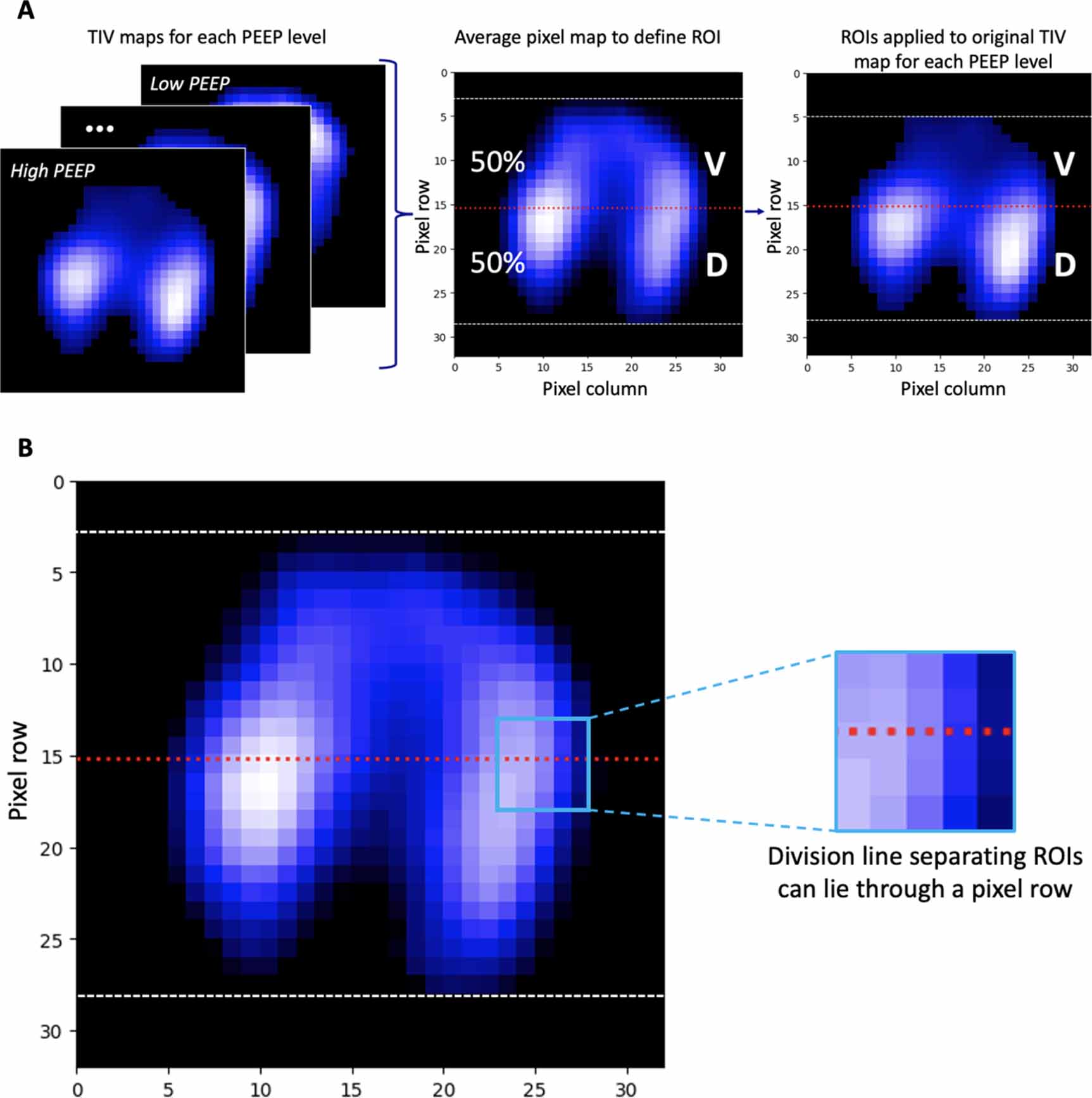 Physiological definition for region of interest selection in electrical ...