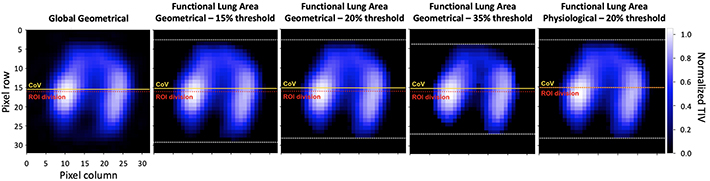 Physiological definition for region of interest selection in electrical ...