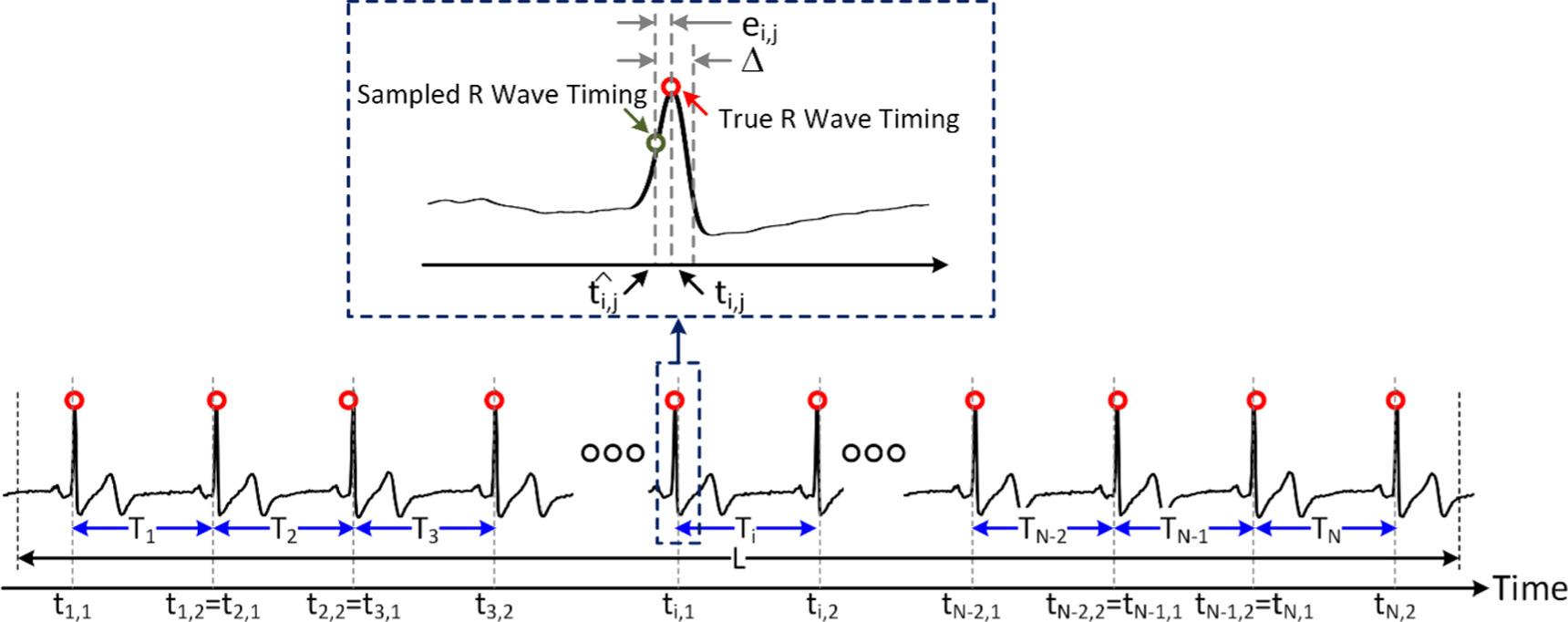 Sampling rate requirement for accurate calculation of heart rate and ...