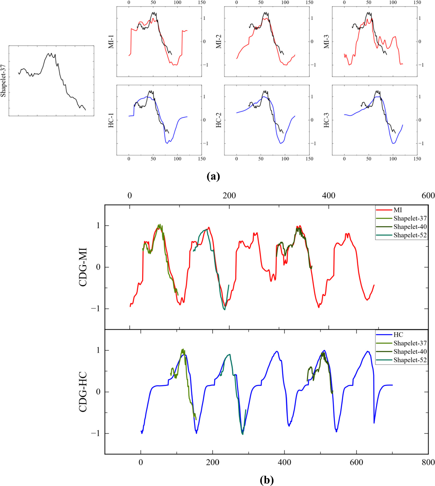 An interpretable shapelets-based method for myocardial infarction detection using dynamic ...