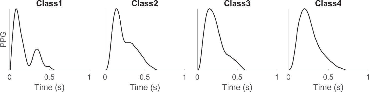 pyPPG: a Python toolbox for comprehensive photoplethysmography signal ...