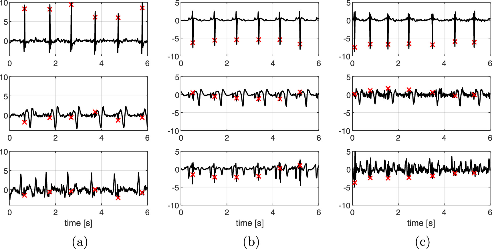 Patient-independent, MHD-robust R-peak detection for retrospective ...