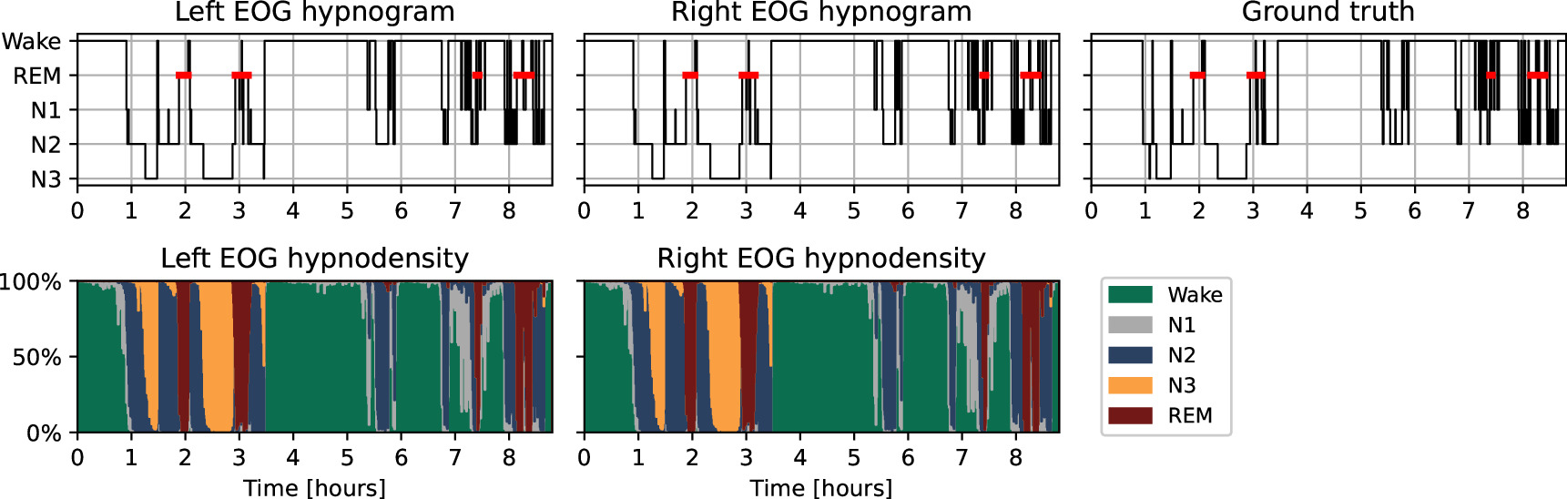 Single-channel EOG sleep staging on a heterogeneous cohort of subjects ...