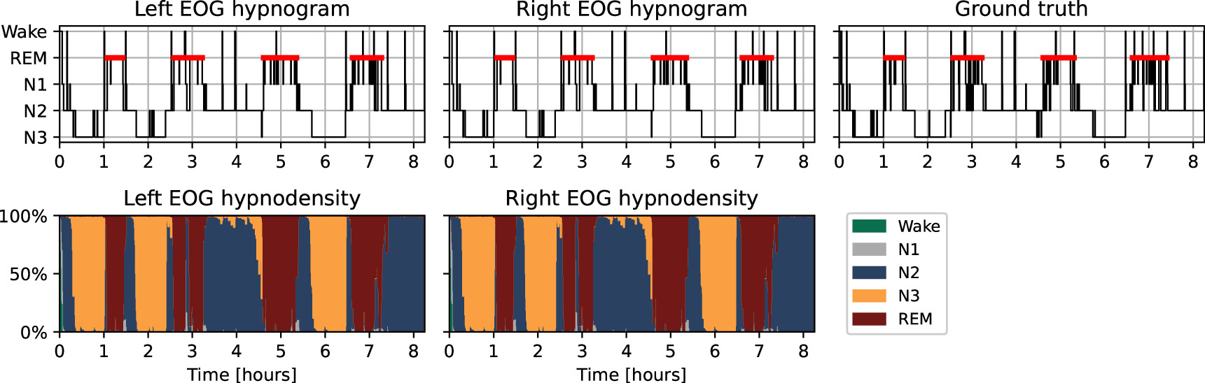Single-channel EOG sleep staging on a heterogeneous cohort of subjects ...
