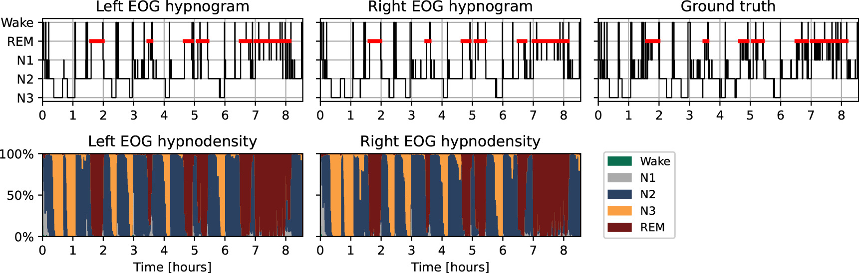 Single-channel EOG sleep staging on a heterogeneous cohort of subjects ...