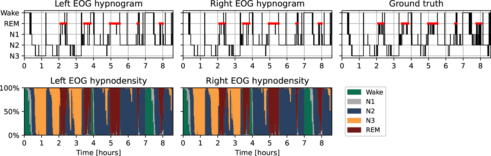 Single-channel EOG sleep staging on a heterogeneous cohort of subjects ...