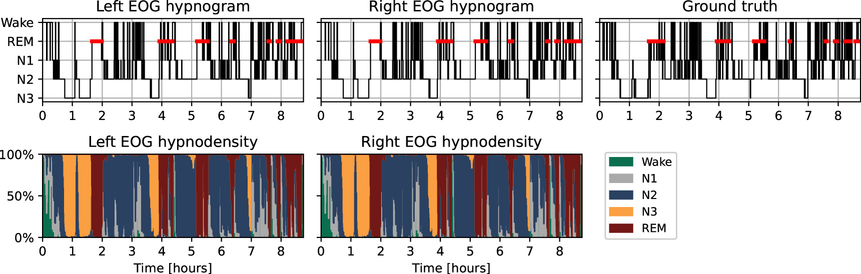 Single-channel EOG sleep staging on a heterogeneous cohort of subjects ...