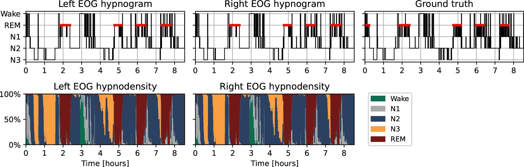 Single-channel EOG sleep staging on a heterogeneous cohort of subjects ...