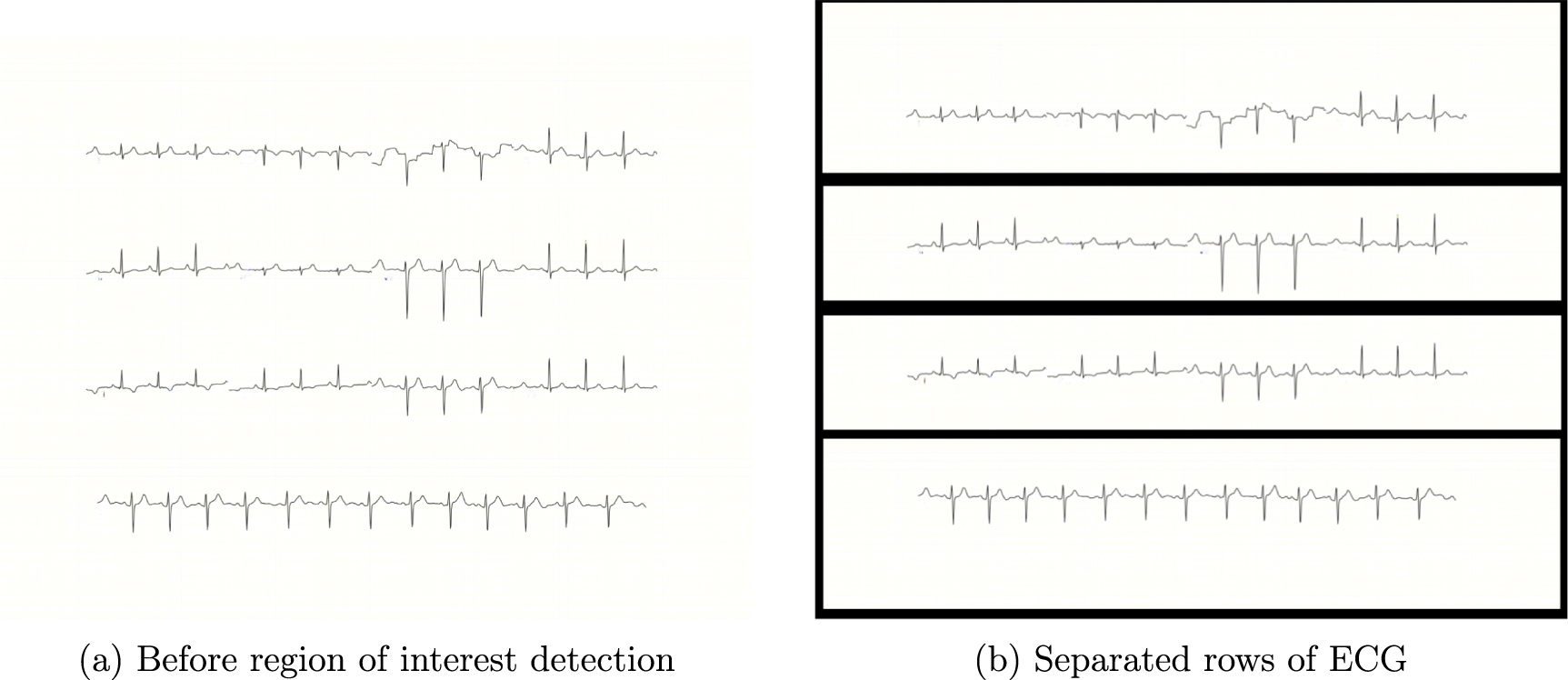ECG-Image-Kit: a synthetic image generation toolbox to facilitate deep ...