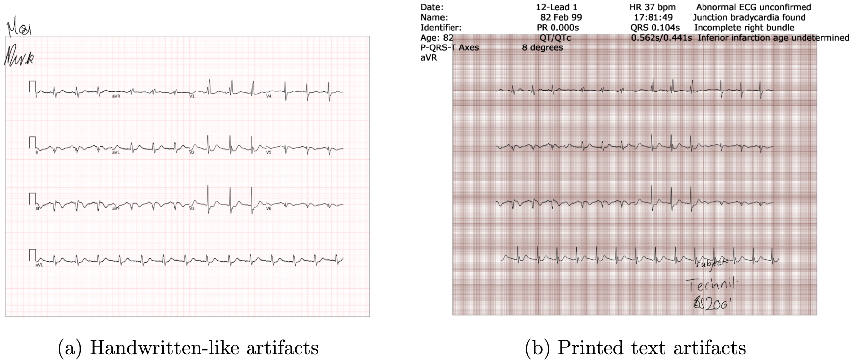 ECG-Image-Kit: a synthetic image generation toolbox to facilitate deep ...