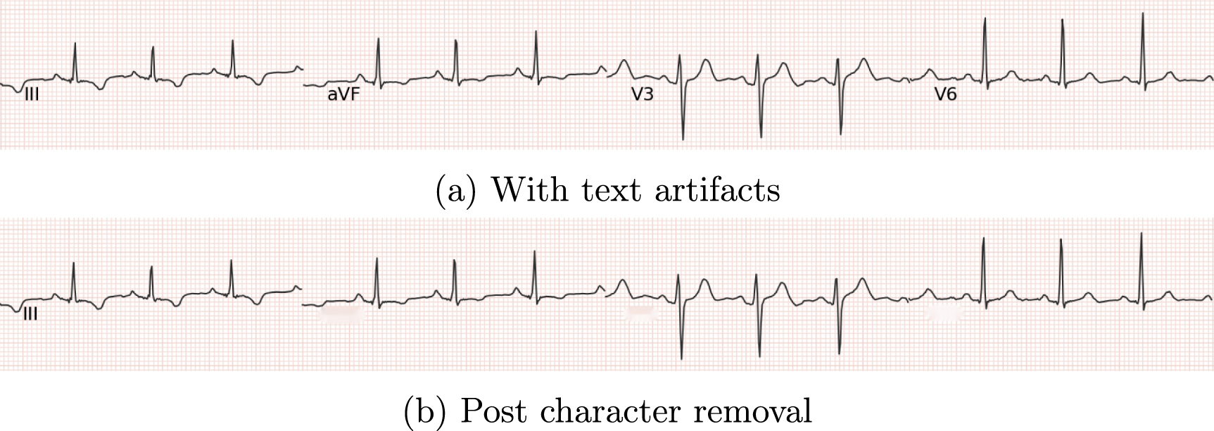 ECG-Image-Kit: a synthetic image generation toolbox to facilitate deep ...
