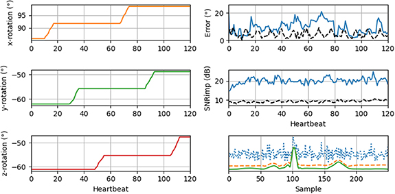 Unsupervised denoising of the non-invasive fetal electrocardiogram with ...