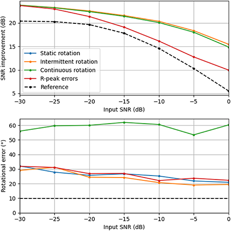 Unsupervised denoising of the non-invasive fetal electrocardiogram with ...