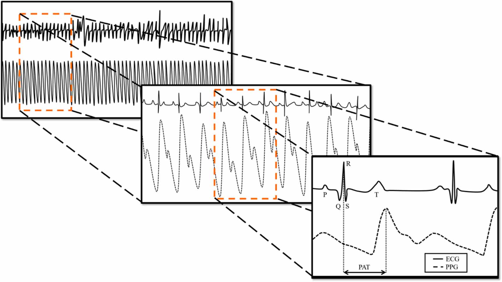 Non-invasive pulse arrival time is associated with cardiac index in ...