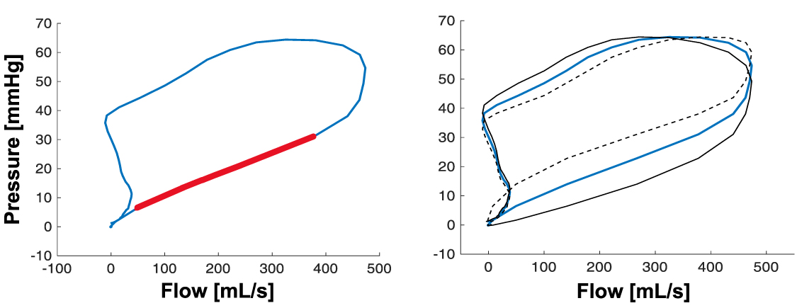 The role of pulse wave analysis indexes for critically ill patients: a ...