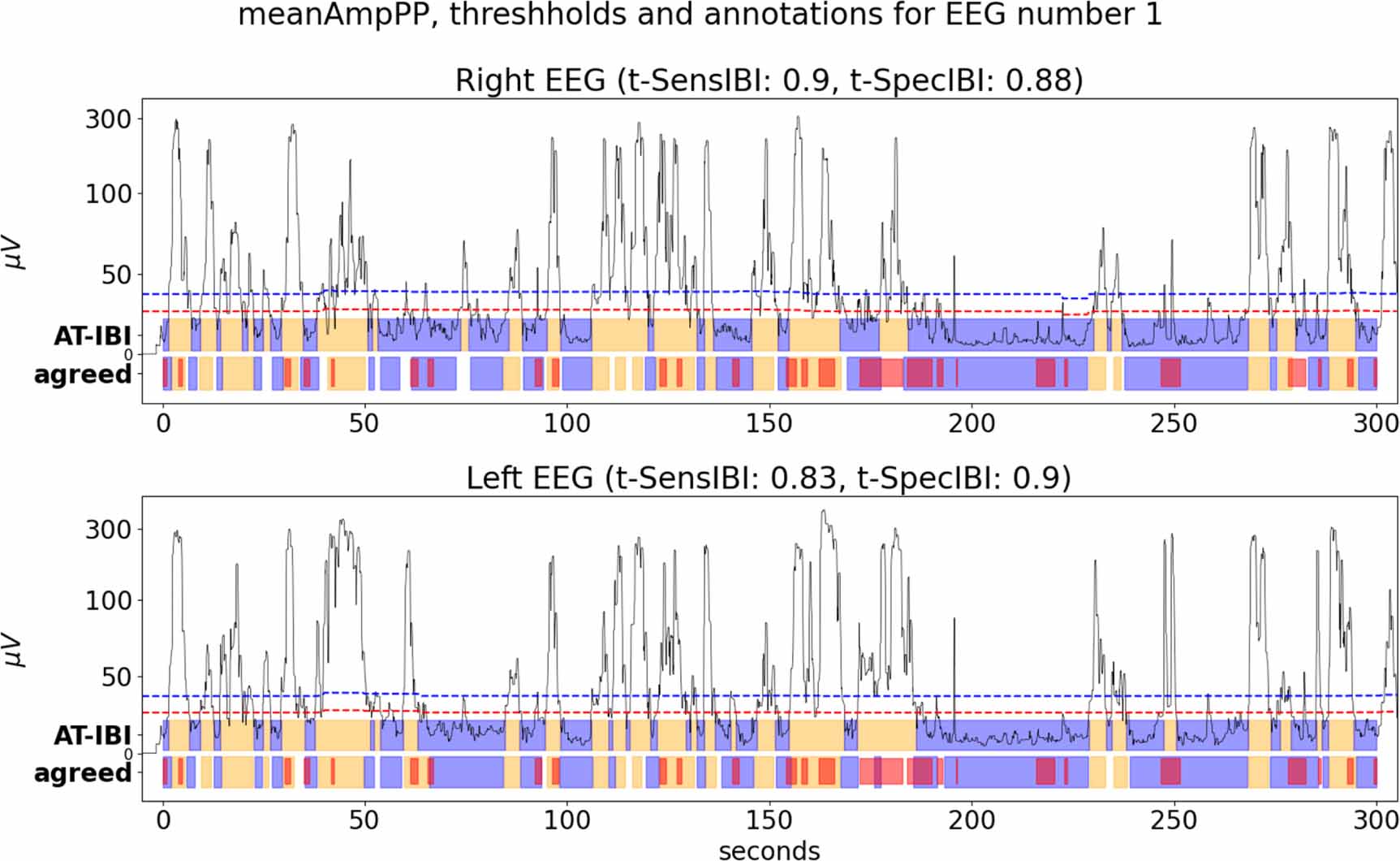 Adaptive threshold algorithm for detecting EEG-interburst intervals in extremely preterm ...