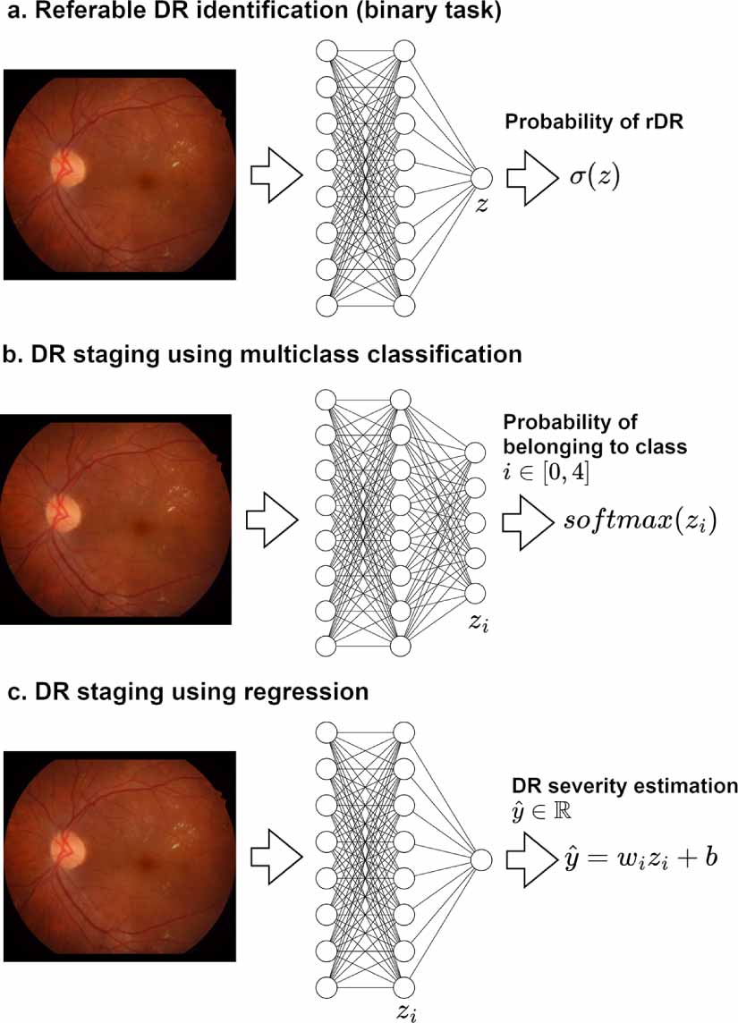 Deep learning generalization for diabetic retinopathy staging from ...
