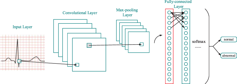 A novel adaptive CNN-LSTM fusion network for electrocardiogram ...