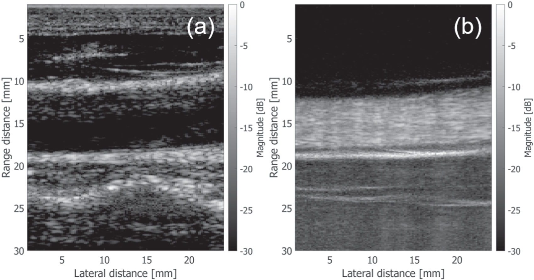 Preliminary investigation on clutter filtering based on deep learning ...