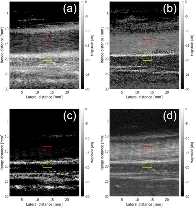 Preliminary investigation on clutter filtering based on deep learning ...
