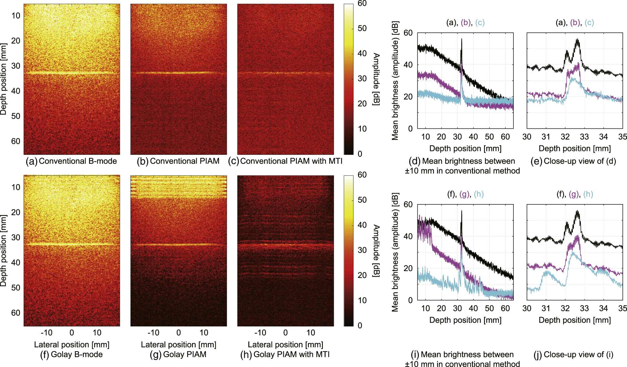 Evaluation of contrast enhancement ultrasound images of Sonazoid ...