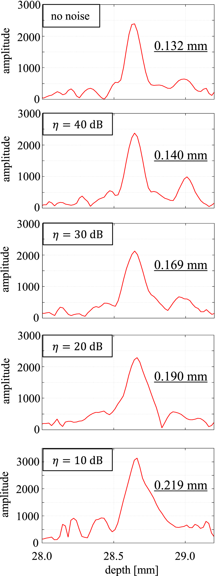 Improving axial resolution of medical ultrasound images by using noise ...