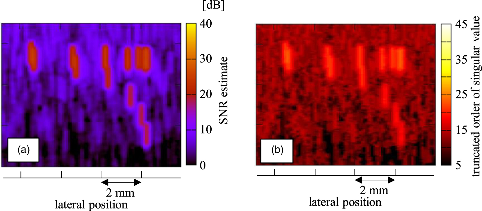 Improving axial resolution of medical ultrasound images by using noise ...