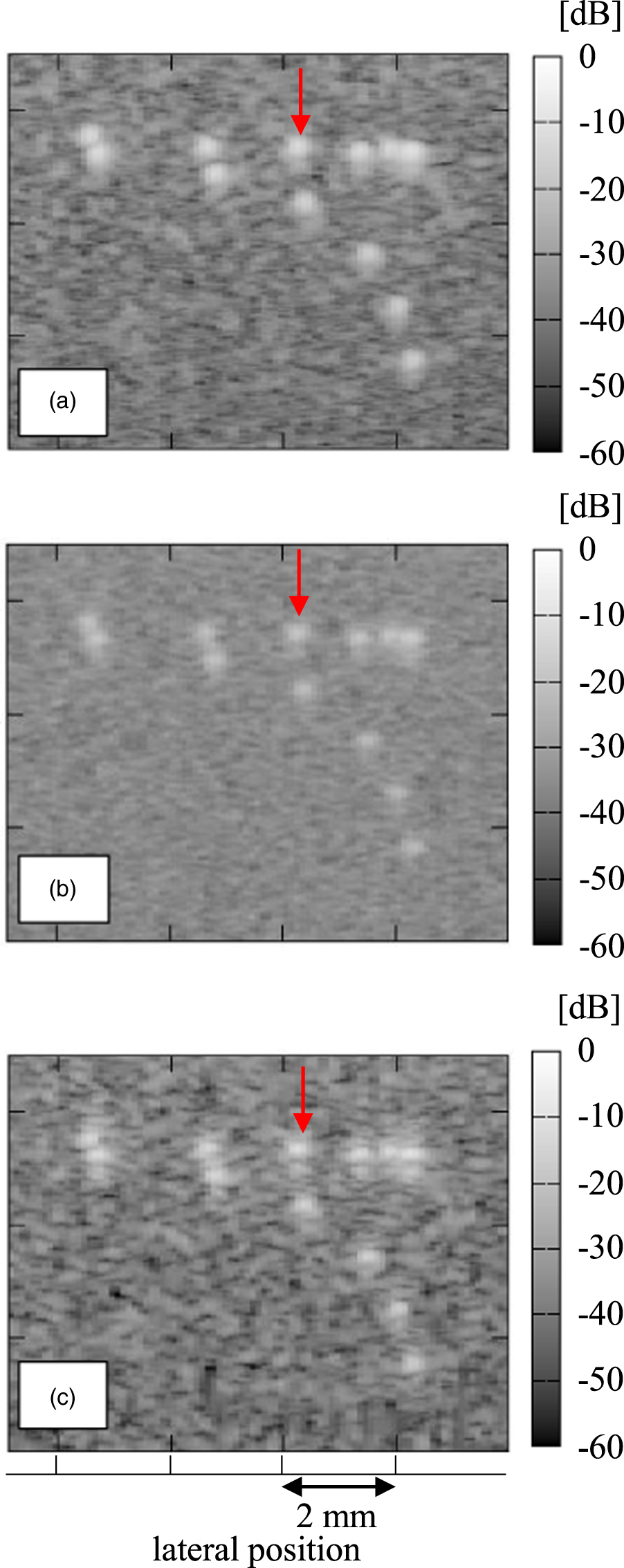 Improving axial resolution of medical ultrasound images by using noise ...